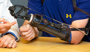 The Upper Limb Library